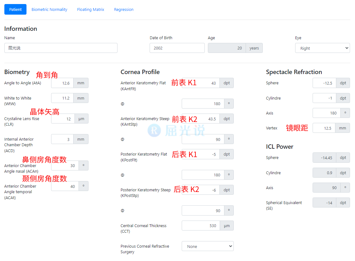 ICL/TICL人工晶体度数计算和尺寸预测工具-屈光说